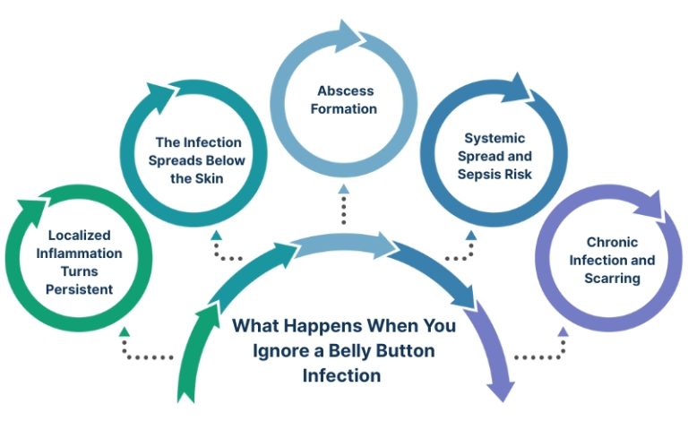 Can a Belly Button Infection Kill You? Treatment & Warning Signs